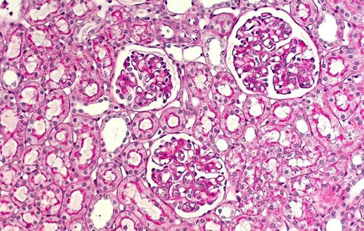 Fabrique de savoirs - Detera Therapeutics développe une solution contre ...
