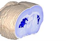 The Knowledge Factory - Neurons and astrocytes are both inculpated in ...