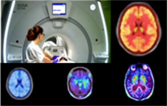 Chris Benoit Brain Scan