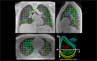 Institut des sciences du vivant Frédéric Joliot - V-LF-SPIRO 3D